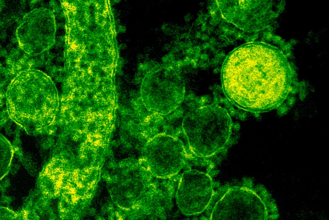 Scientists Uncover Microbe That Uses Electricity to Survive