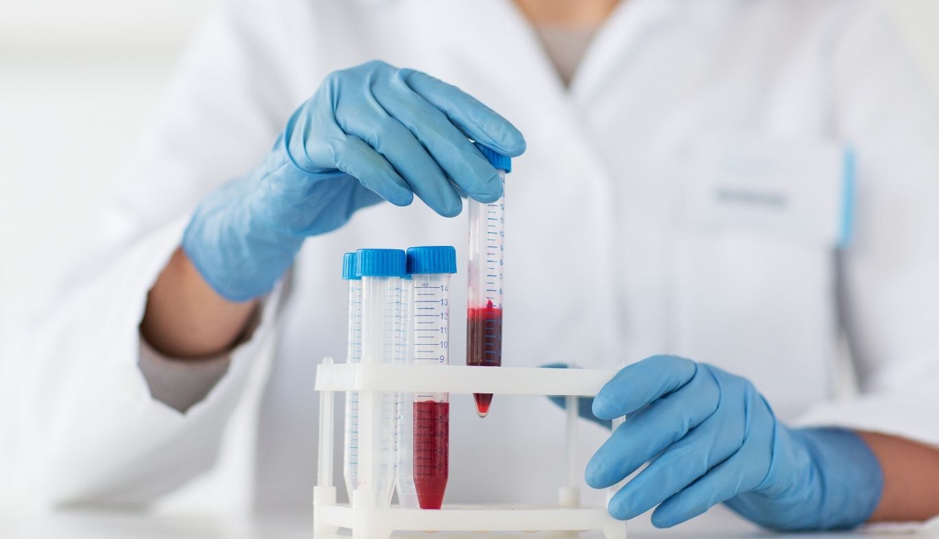 Scientists Discover the World's Rarest Blood Group